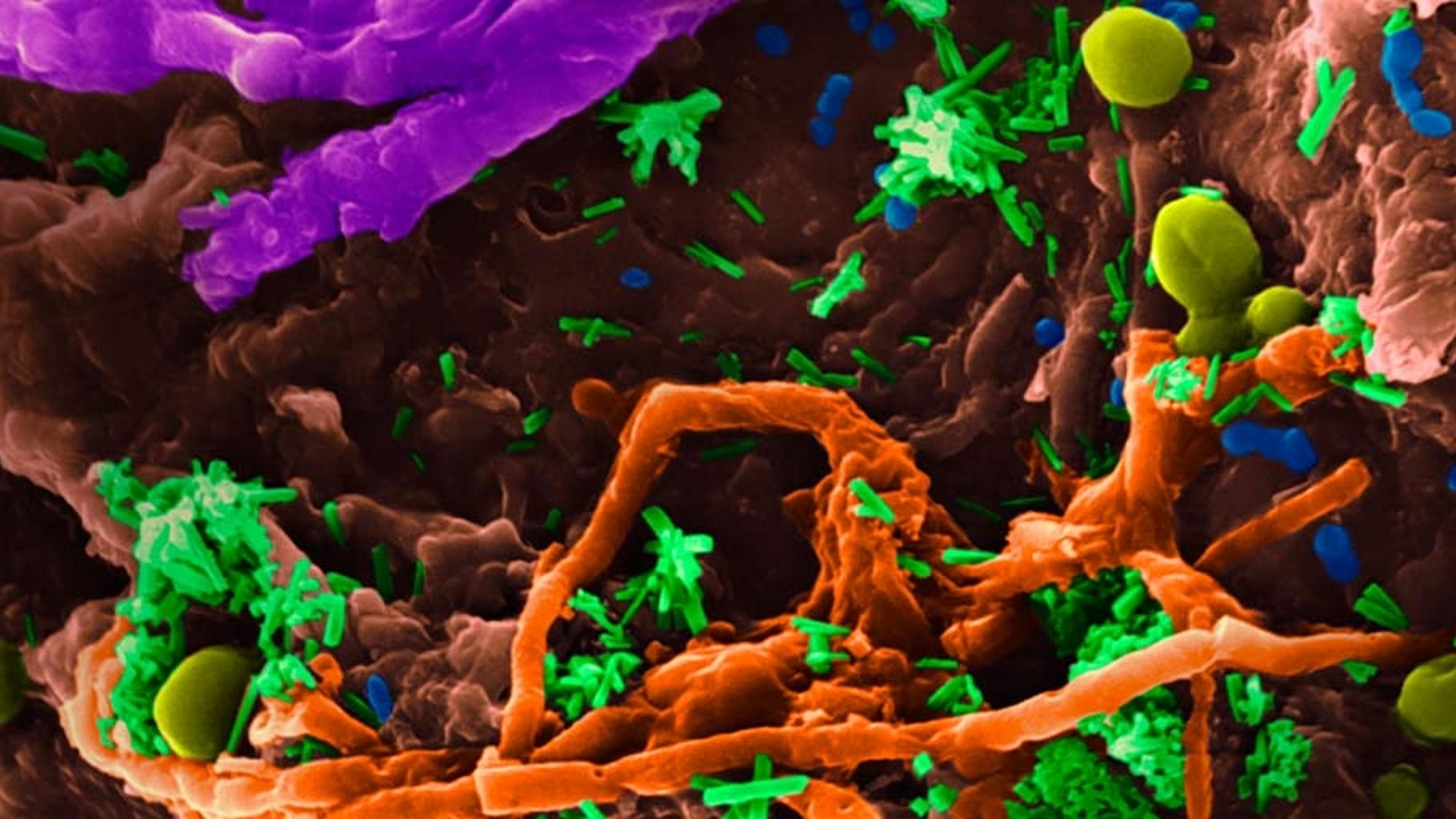 A variety of bacteria, yeast, and fungus on a kitchen sponge - Bing Gallery